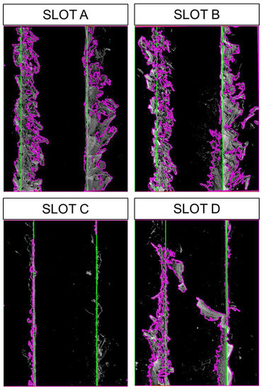 Image Processing Approach to Investigate the Correlation between ...