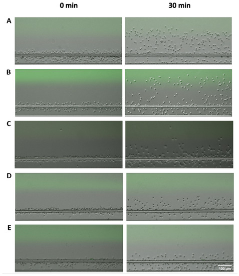 Bronchoalveolar Lavage Fluid from Chronic Obstructive Pulmonary Disease ...