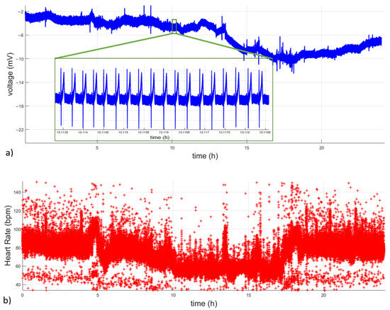 Implementation of Wavelet-Transform-Based Algorithms in an FPGA for Heart Rate and RT Interval ...