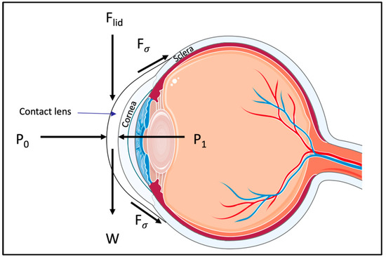 Advancements in Wearable and Implantable Intraocular Pressure ...