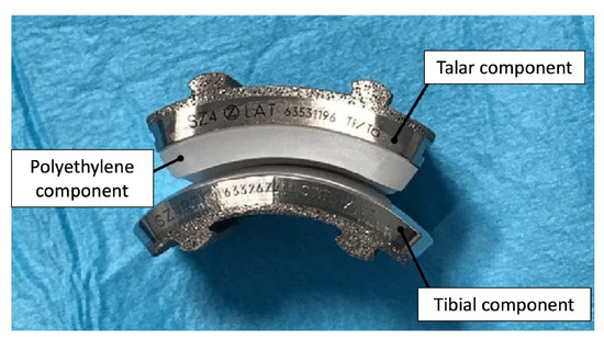 Ankle and Foot Arthroplasty and Prosthesis: A Review on the Current and ...