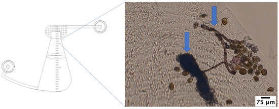 Micromachines | Free Full-Text | Enhancing the Yield of a Lab-on-a-Disk ...