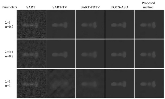 Micromachines | Free Full-Text | Reconstruction of Sparse-View X-ray Computed Tomography Based ...
