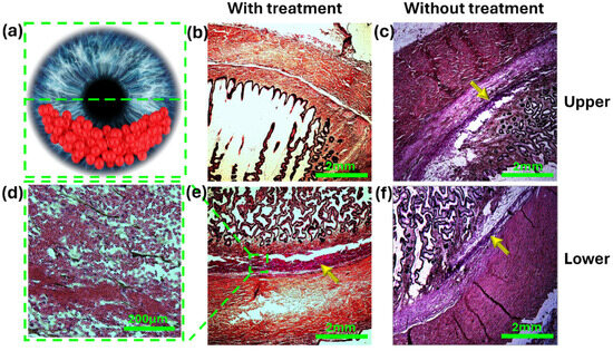 Harnessing Standing Sound Waves to Treat Intraocular Blood Cell ...