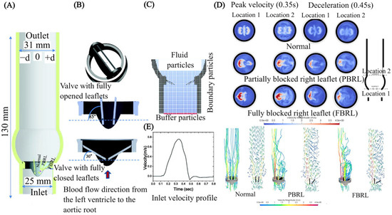 Micromachines | Free Full-Text | Computational Fluid–Structure Interaction in Microfluidics