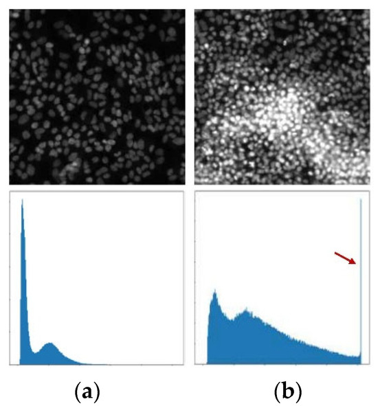 A Saturation Artifacts Inpainting Method Based on Two-Stage GAN for ...