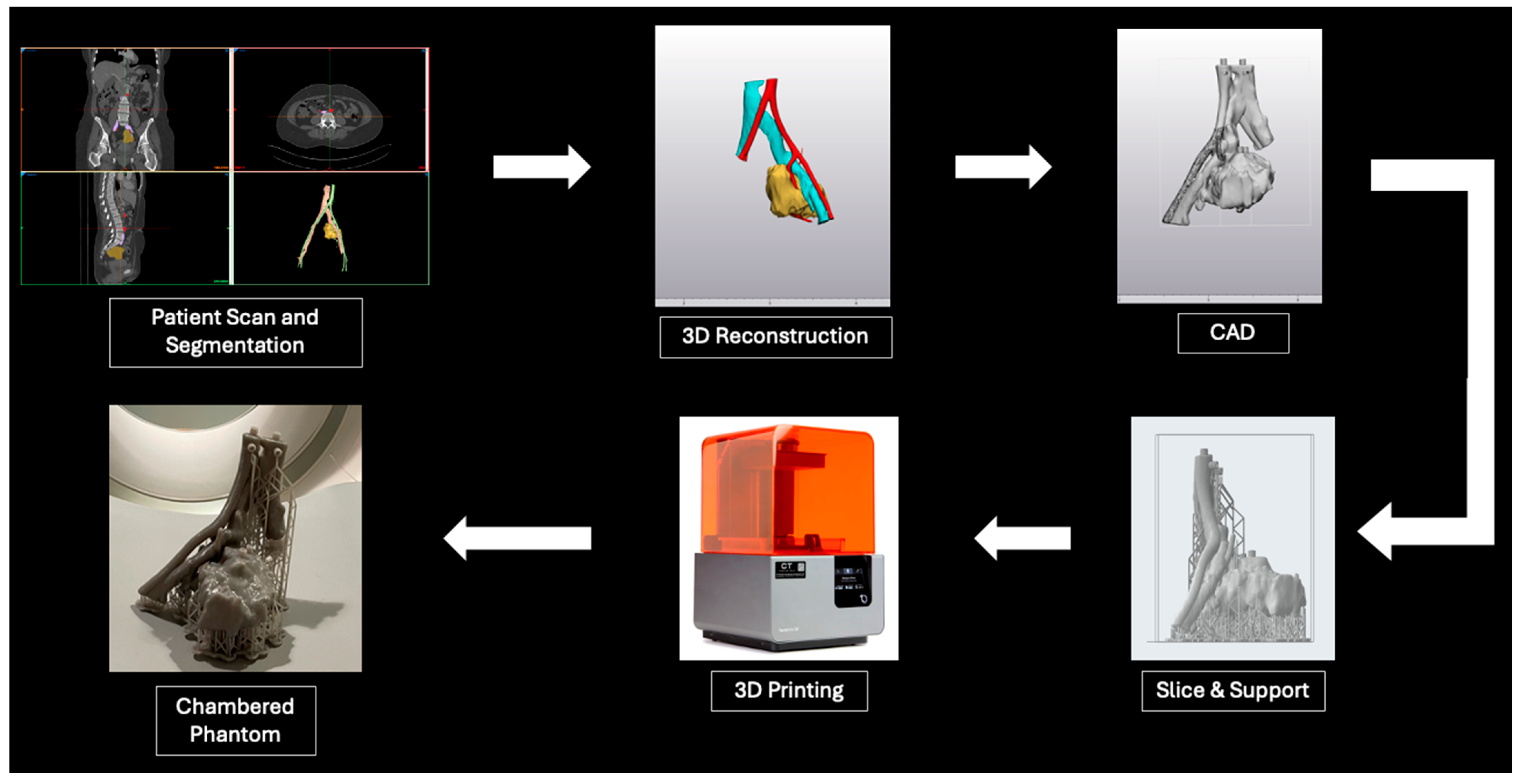 Micromachines | Free Full-Text | Customization of Computed Tomography Radio-Opacity in 3D ...