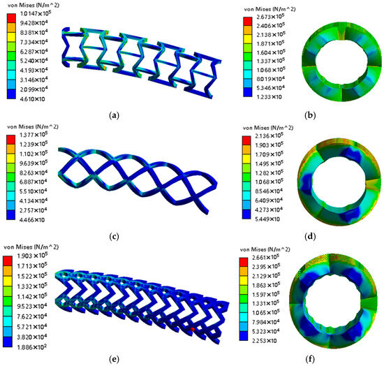 Mechanical Property of Thermoplastic Polyurethane Vascular Stents ...