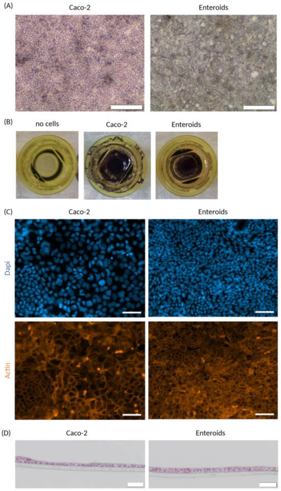 Intestinal Cells-on-Chip for Permeability Studies