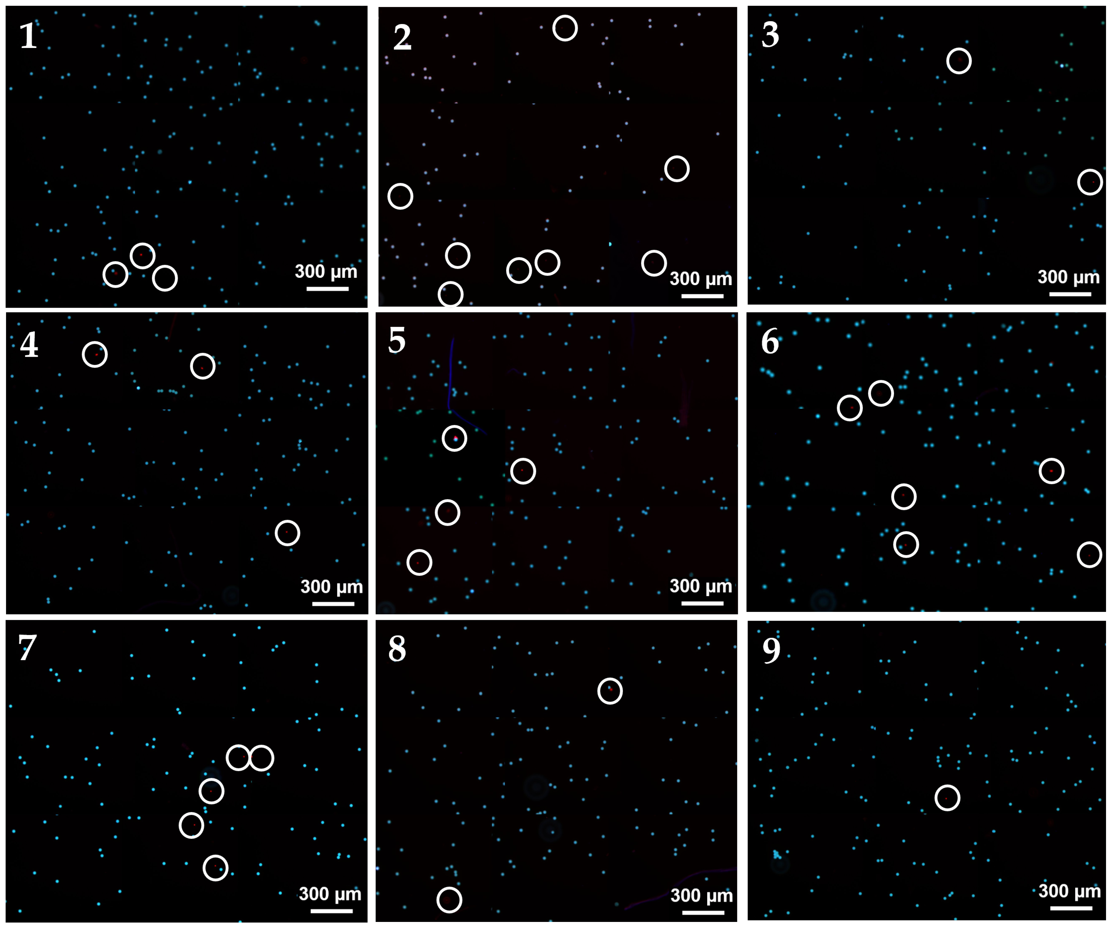 Design and Performance Analysis of Spiral Microchannels for Efficient Particle Separation Using ...