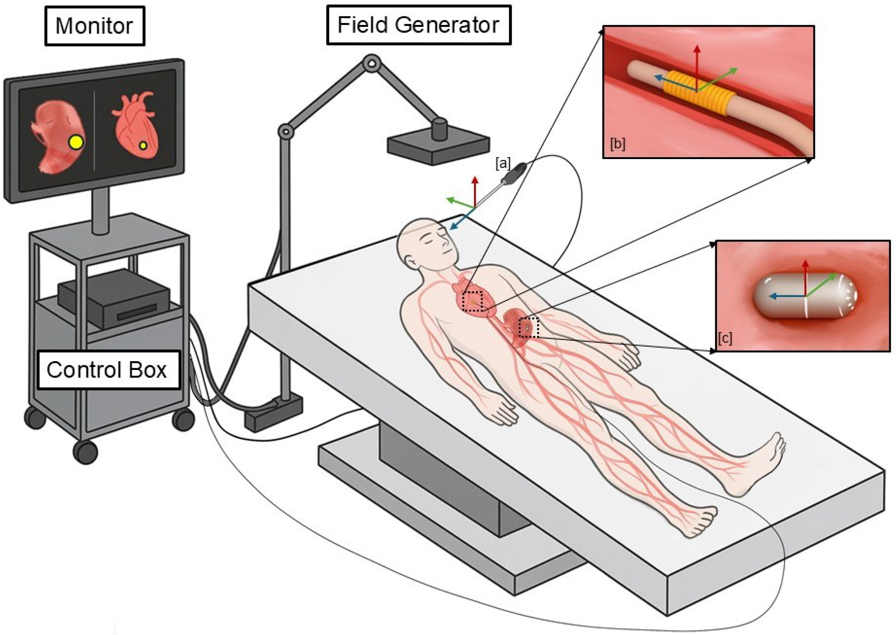 Electromagnetic Tracking System for Medical Micro Devices: A Review