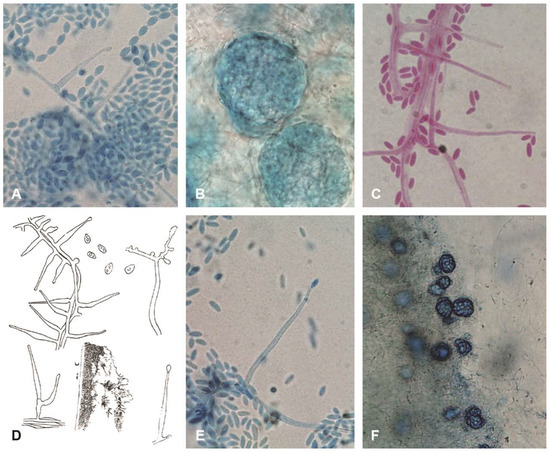 The Protean Acremonium. A. sclerotigenum/egyptiacum: Revision, Food ...