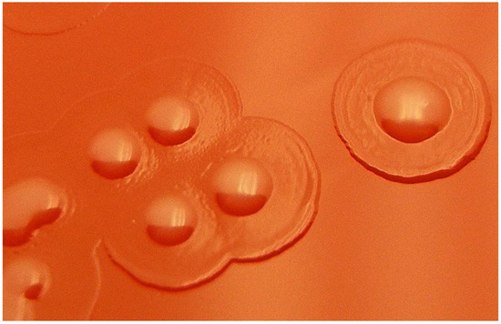 Moraxella nonliquefaciens and M. osloensis Are Important Moraxella ...