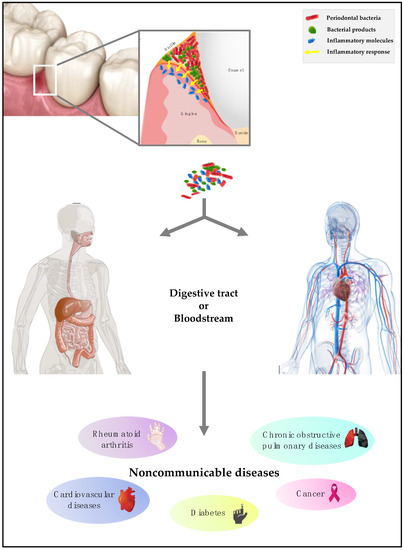 Periodontal Pathogens as Risk Factors of Cardiovascular Diseases ...