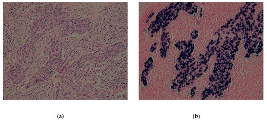 Establishment of a Screening Method for Epstein-Barr Virus-Associated ...