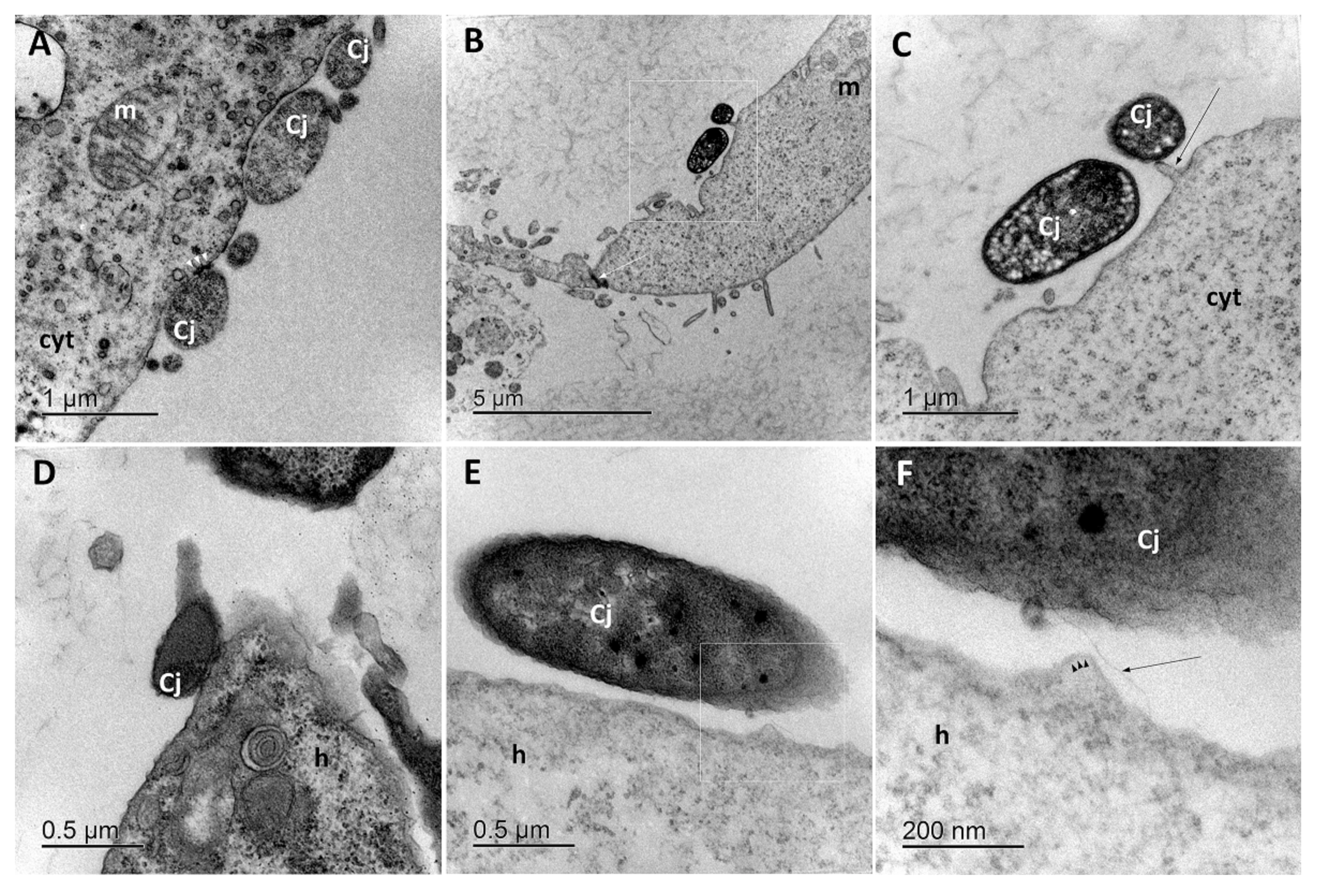 Adhesion of Campylobacter jejuni Is Increased in Association with ...