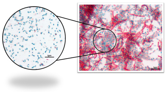 Antimicrobial Photodynamic Therapy in the Control of Pseudomonas ...