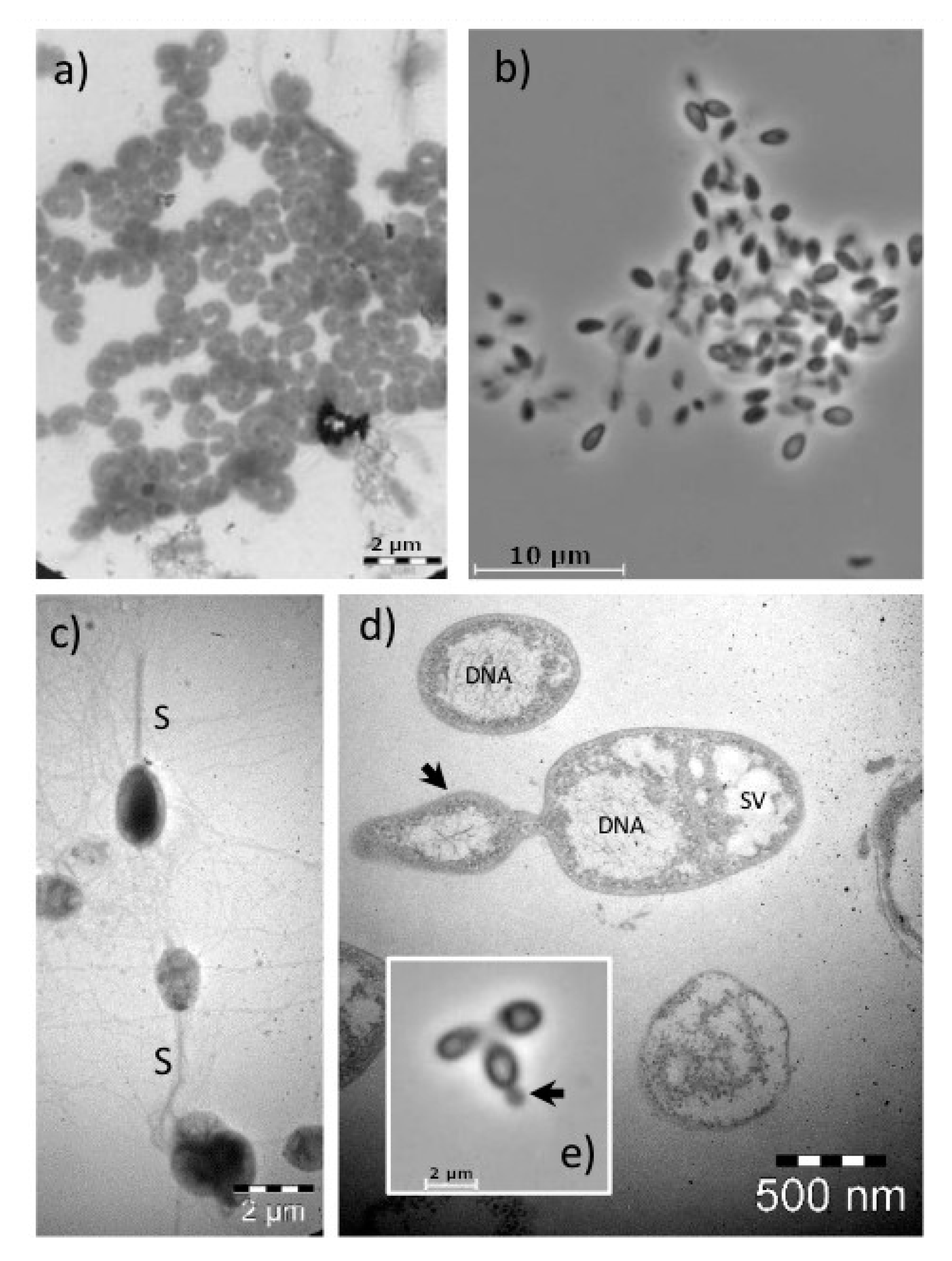 Planctomycetes as a Vital Constituent of the Microbial Communities ...