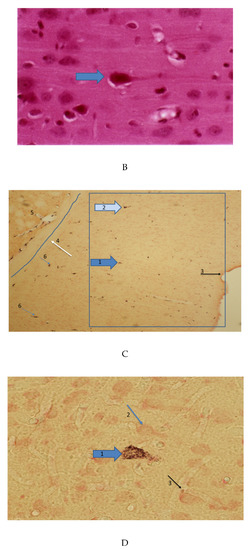The HIV-1 Transgenic Rat: Relevance for HIV Noninfectious Comorbidity ...