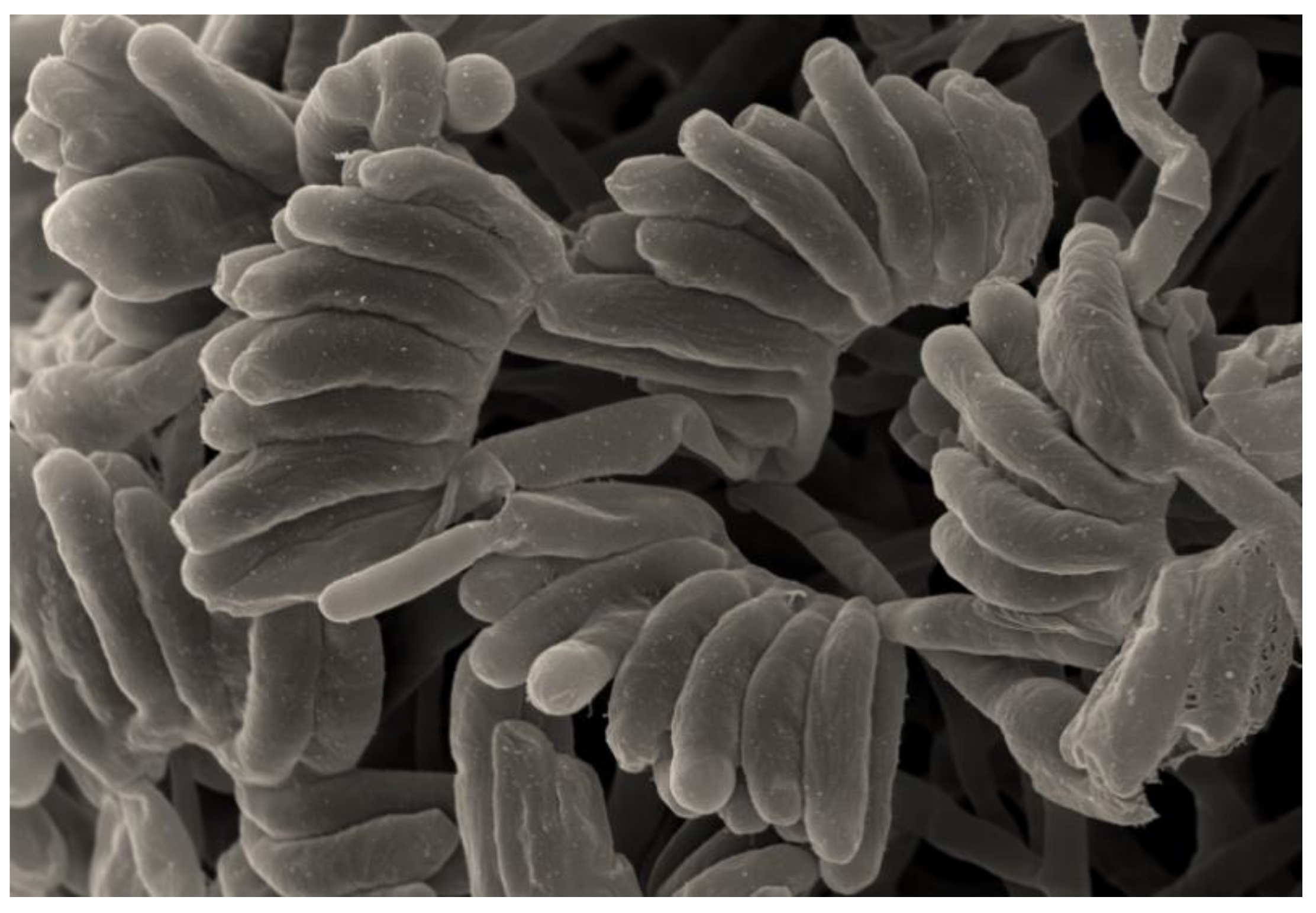 Diversity of Actinobacteria Isolated from Date Palms Rhizosphere and ...