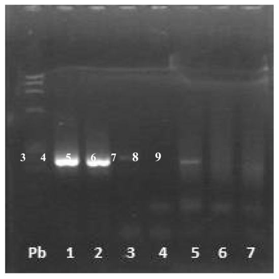 PCR Detection of Toxoplasma gondii in European Wild Rabbit (Oryctolagus ...