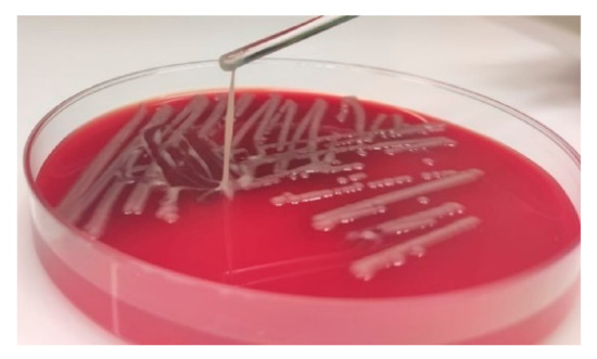 Hypervirulent Klebsiella pneumoniae of Lineage ST66-K2 Caused ...