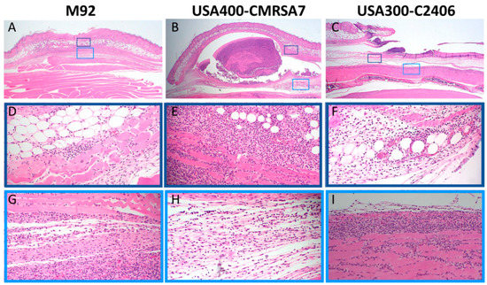 A Murine Skin Infection Model Capable of Differentiating the ...
