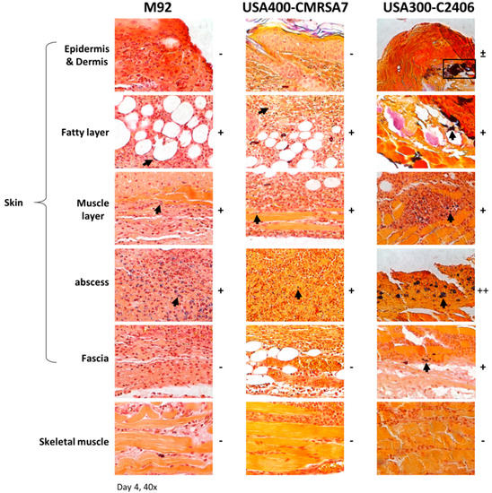 A Murine Skin Infection Model Capable of Differentiating the ...
