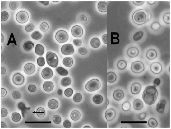 Microorganisms | Free Full-Text | Novakomyces olei sp. nov., the First ...