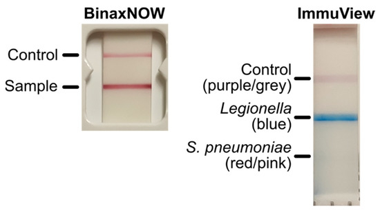 Evaluation of Four Lateral Flow Assays for the Detection of Legionella ...