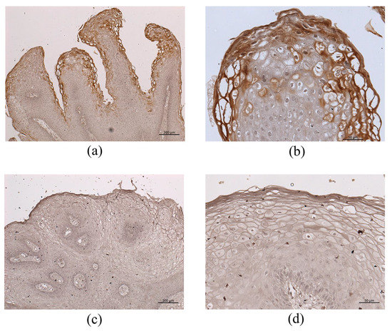 Microorganisms | Free Full-Text | Coordinated Expression of HPV-6 Genes ...