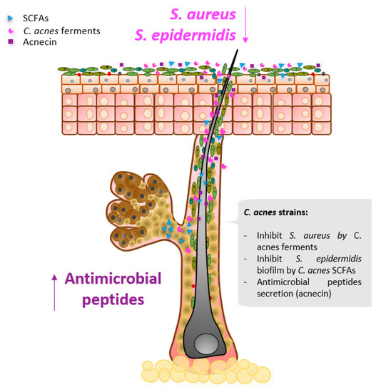From Dysbiosis to Healthy Skin: Major Contributions of Cutibacterium ...