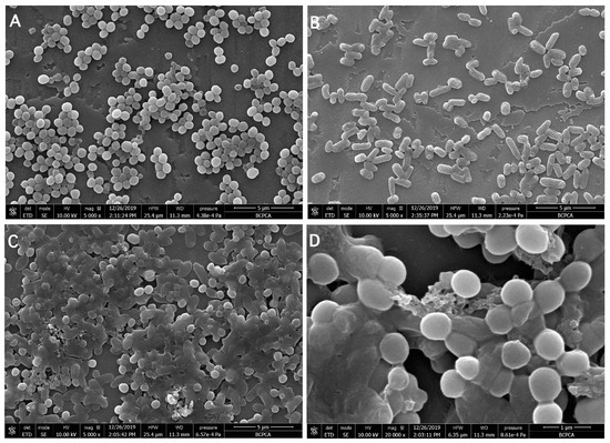 Understanding the Interactions between Staphylococcus aureus and the ...