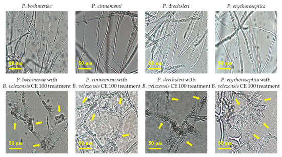 Microorganisms | Free Full-Text | Bacillus velezensis CE 100 Inhibits ...