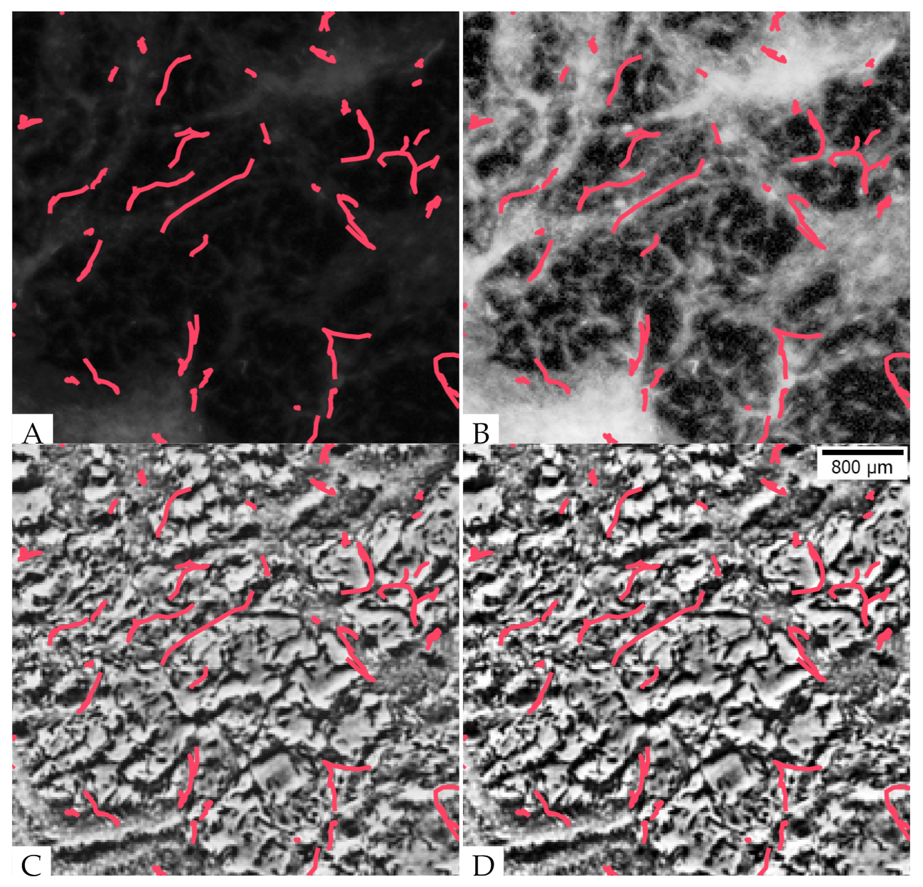 Quantification of Myxococcus xanthus Aggregation and Rippling Behaviors ...