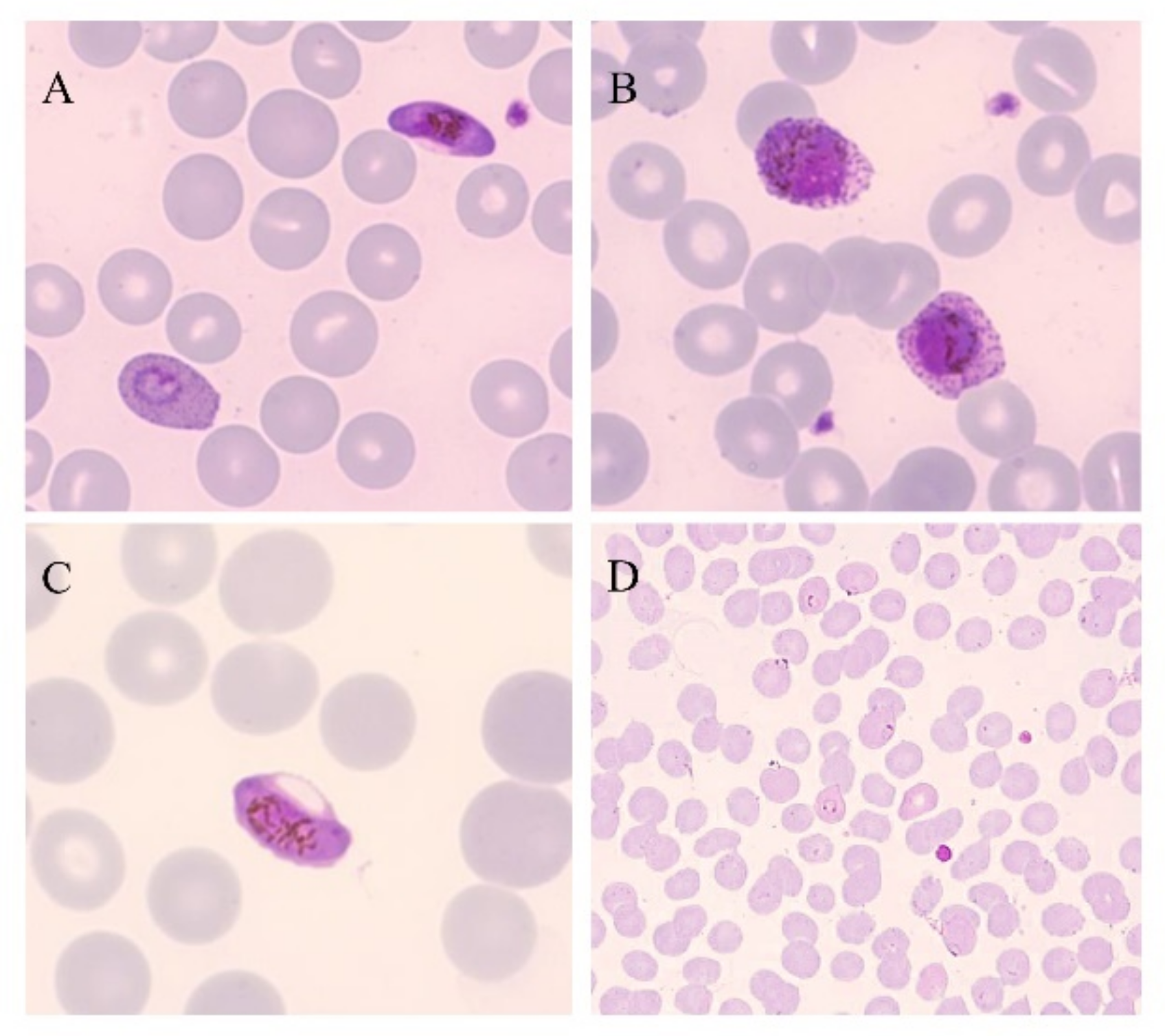 Plasmodium Falciparum Characteristics Hot Sex Picture