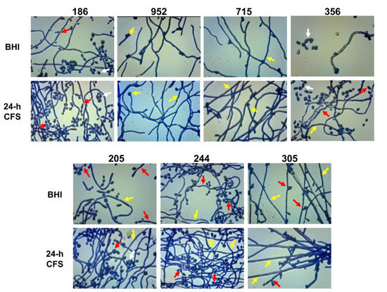 Lactobacillus iners Cell-Free Supernatant Enhances Biofilm Formation ...
