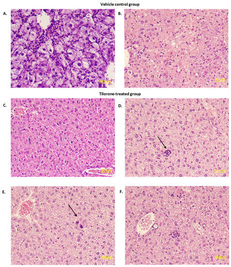 Microorganisms | Free Full-Text | Tilorone-Dihydrochloride Protects ...