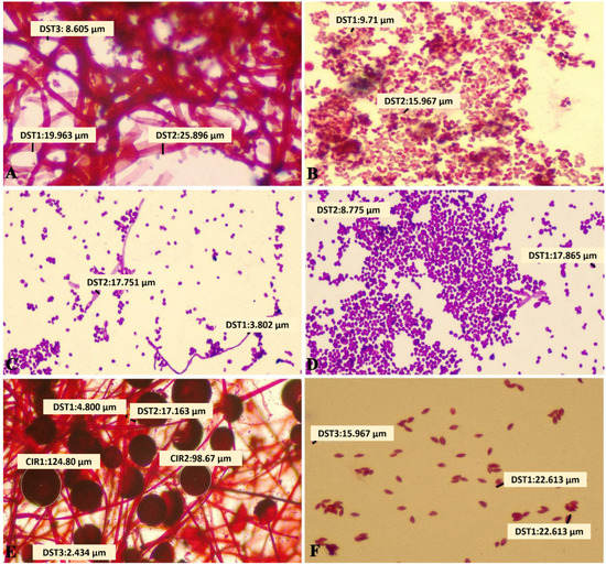 Alternate Special Stains for the Detection of Mycotic Organisms in Oral ...