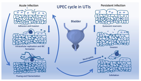 Urinary Tract Infections Caused by Uropathogenic Escherichia coli ...