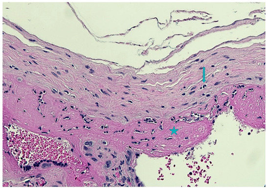 Microorganisms | Free Full-Text | Congenital Syphilis Presenting with ...