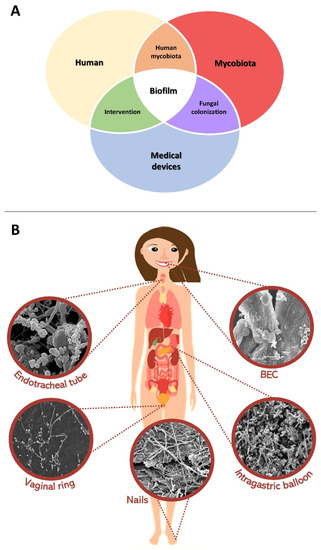 Mixed Fungal Biofilms: From Mycobiota to Devices, a New Challenge on ...