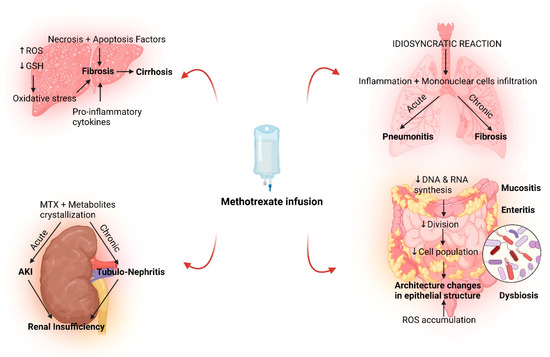 The Protective Effects of Nutraceutical Components in Methotrexate ...
