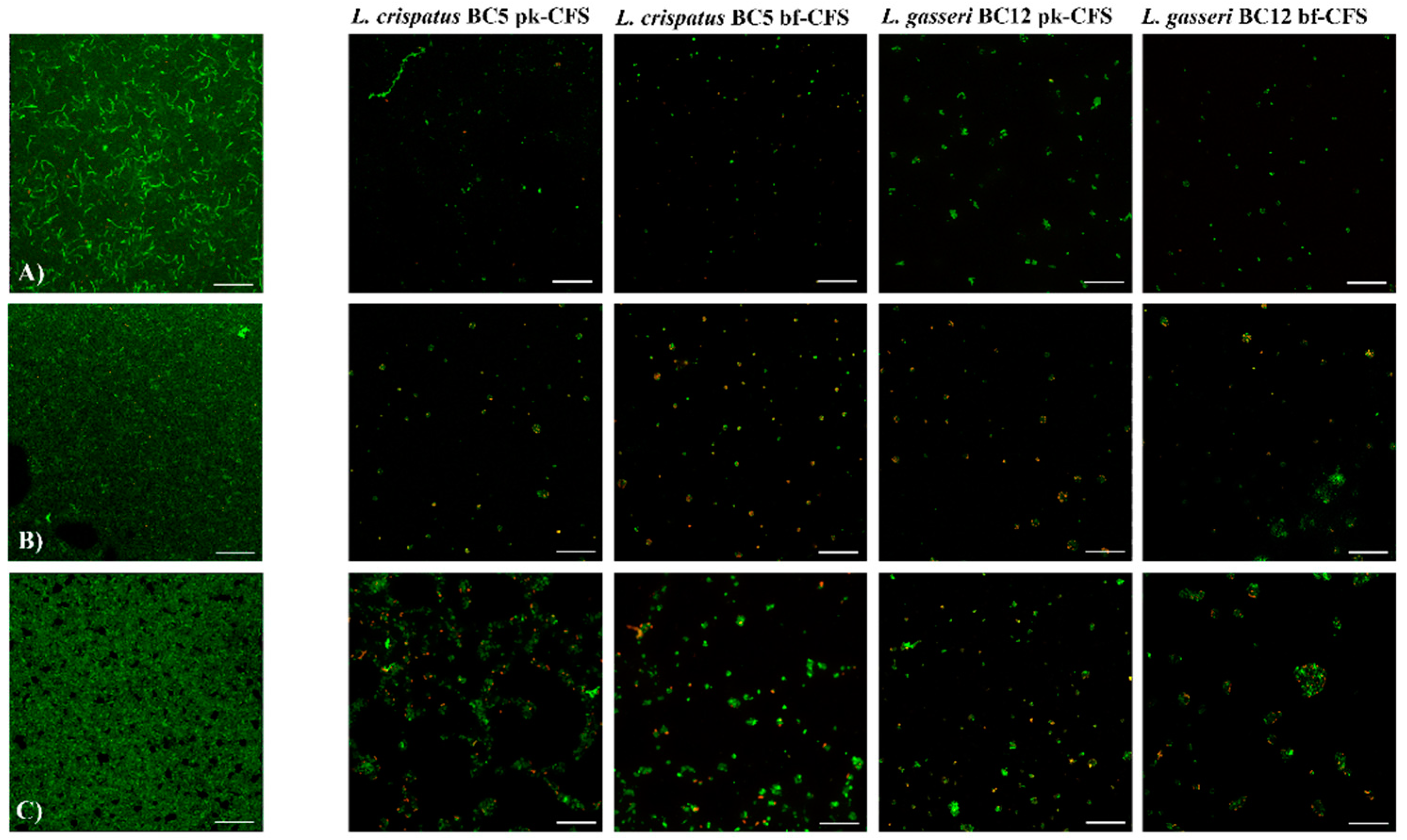 Vaginal Lactobacillus Impair Candida Dimorphic Switching and Biofilm ...