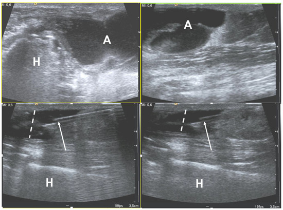 Imaging of Musculoskeletal Soft-Tissue Infections in Clinical Practice ...