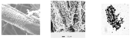 Degradation of Cellulose and Hemicellulose by Ruminal Microorganisms
