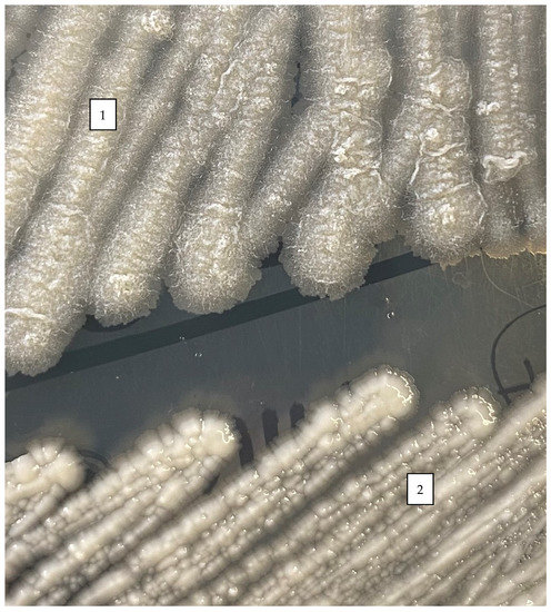 Updated Review on the Mechanisms of Pathogenicity in Mycobacterium ...