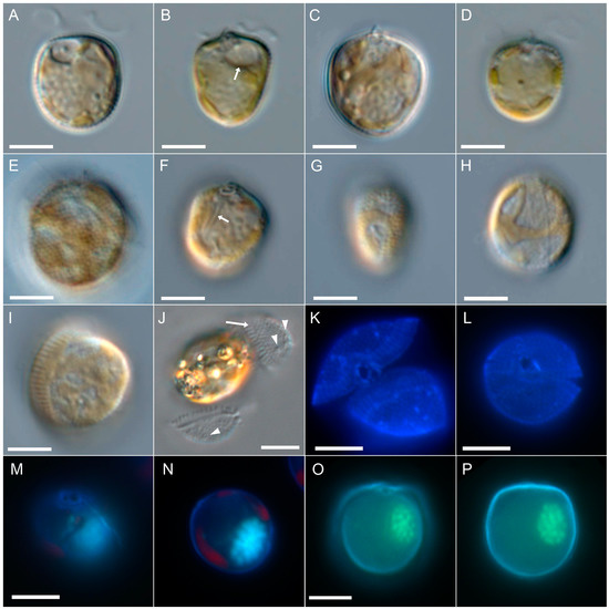 Morphological and Phylogenetic Characterisation of Prorocentrum ...
