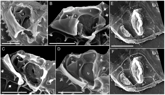 Morphological and Phylogenetic Characterisation of Prorocentrum ...
