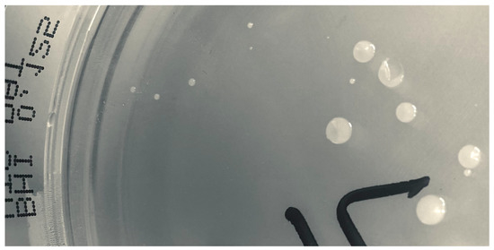 Corynebacterium striatum Prosthetic Joint Infection Successfully ...